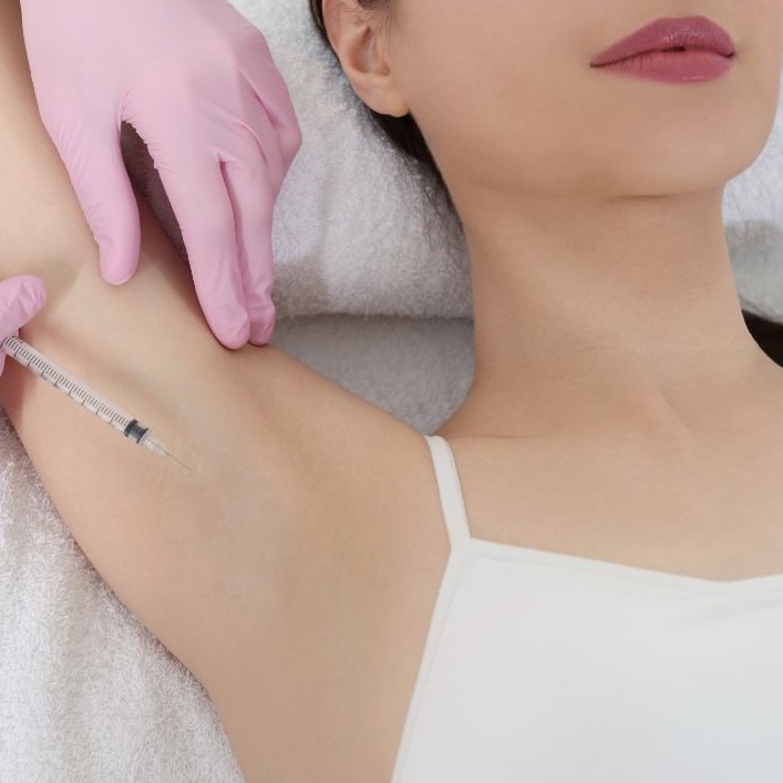 Hyperhidrosis Solutions: Sweat Less in Forest Hill